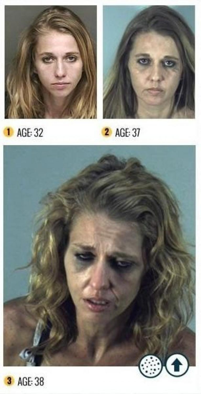 Les ravages de la drogue résumés en 18 photos avant/après de personnes ...